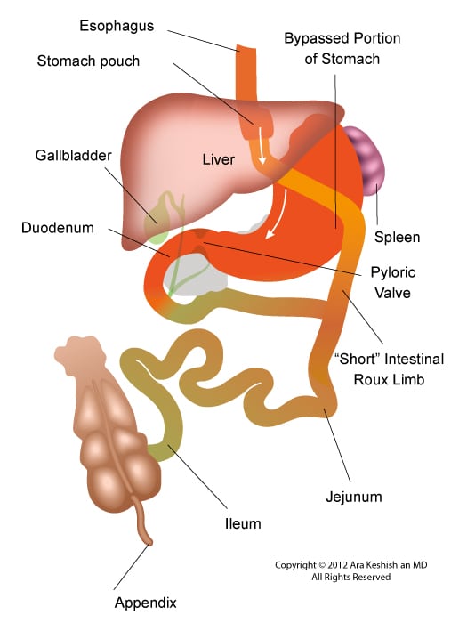 Gastric Bypass Anatomy Anastomosis Roux En Y Roux En Y Anastomosis 